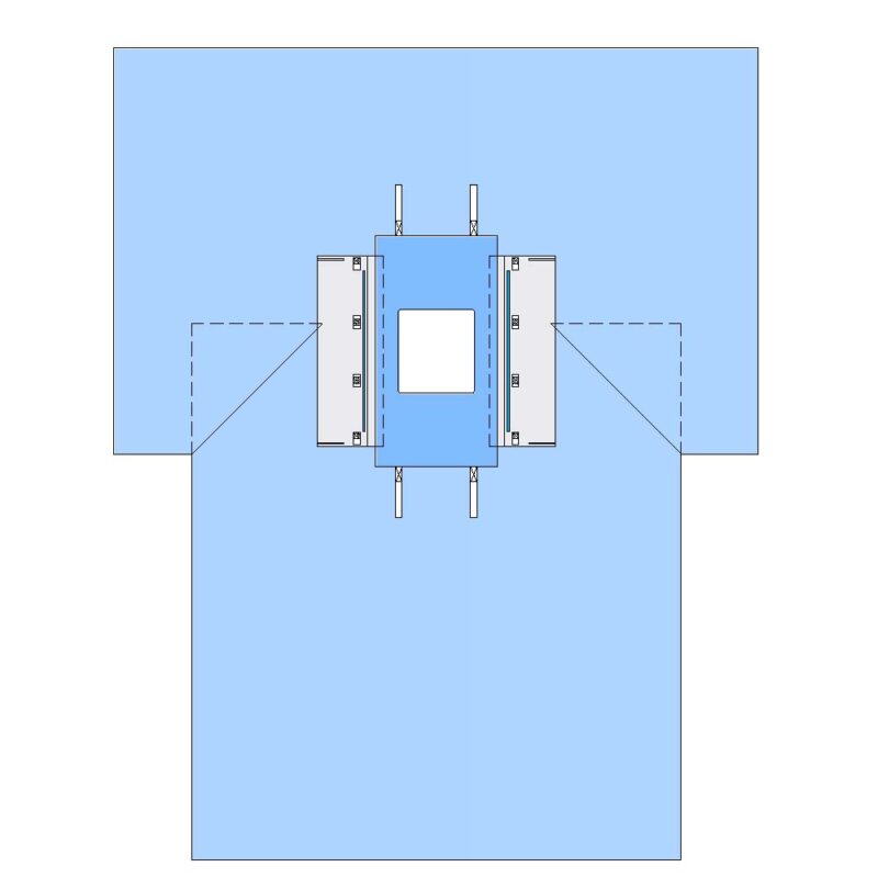 Laparoscopic Cholecystectomy Drape w/ Pouches | Alleset